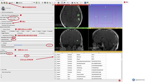 Lis 影像组学视频学习笔记34 使用3d Slicer软件提取影像组学特征 影像组学科研世界 国内第一个影像组学论坛
