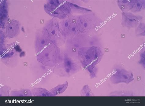 Cheek Epithelial Cells