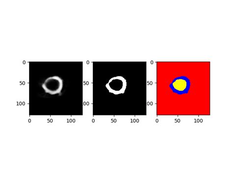 Python X How To Calculate The Internal Area Count Of Pixels Inside A Ring Like Shape