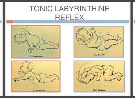 Benefits Of The Tonic Labyrinthine Reflex Tlr For Optimal 56 Off