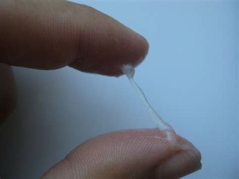 Cervical Fluid Pictures