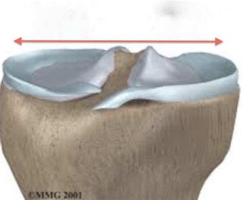 Module Lower Extremity Tibia Flashcards Quizlet