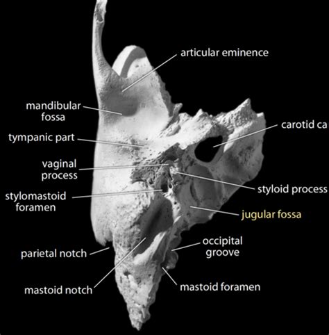 Mastoid Notch Function