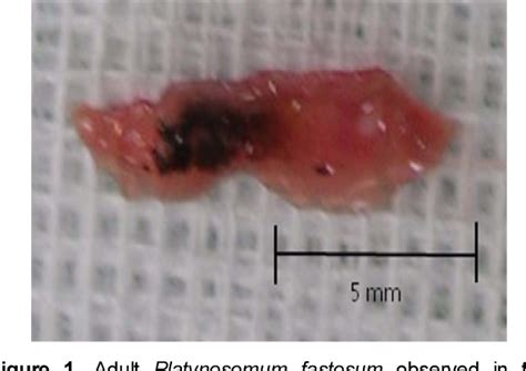 Figure 1 From Platynosomum Fastosum Infestation In A Domestic Cat In Korea Semantic Scholar