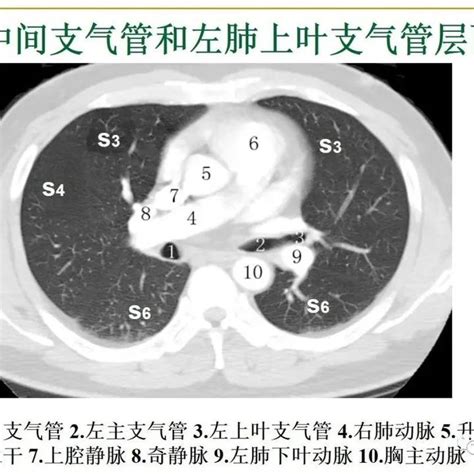 胸部ct读片技巧汇总 知乎