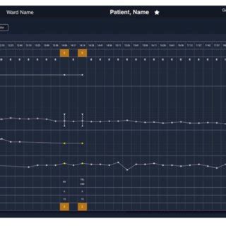 Exemplar Augmented E Obs Chart From The Clinician Dashboard Showing Download Scientific