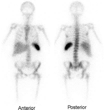 Nucs What S This Scan Flashcards Quizlet