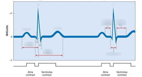 Ekg Waveform Components Diagram Quizlet