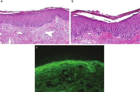 Histopathological Findings Hematoxylin Eosin Stain Original