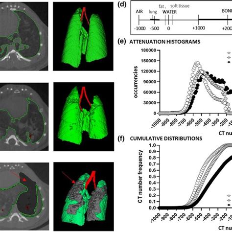 Lung Segmentation Protocols And Analysis A B Semi Automatic