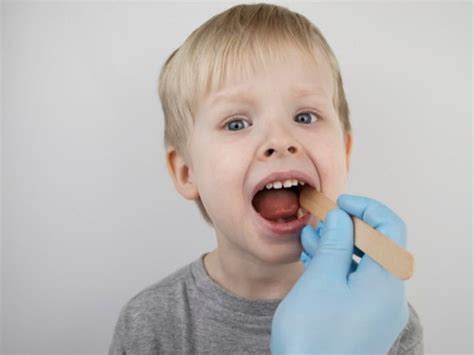 التهاب اللوزتين الوقاية وطرق العلاج ومتى تجب الجراحة؟ الأسبوع