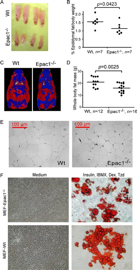Epac1 Deficiency Reduces Plasma Leptin Levels Fasting Plasma Leptin