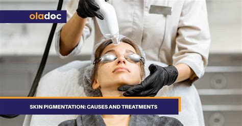 Skin Pigmentation Causes And Treatments