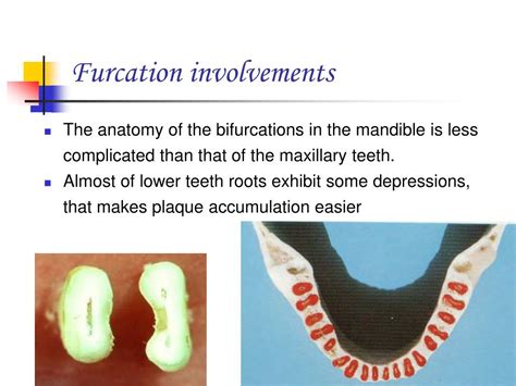 Ppt Pre Clinical Periodontics Powerpoint Presentation Free Download