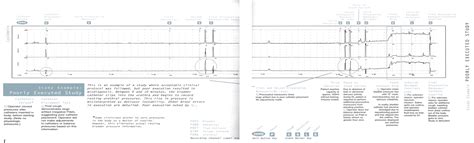 Normal Uroflow Chart Minga
