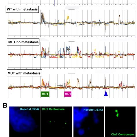 Array Based Comparative Genome Hybridization Acgh Analysis Discloses Download Scientific