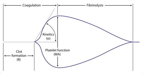 Background And Evaluation Of Hypercoagulability Pmc
