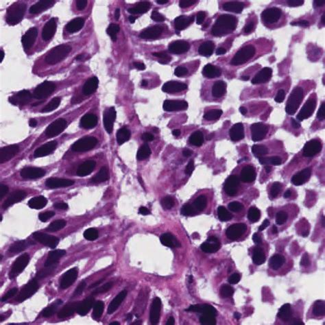 Input Intermediate Results And Output Of The Post Processing Pipeline