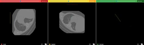 Vtk Image Mapper Compute Closest Ijk Axis Fails For This Case · Issue
