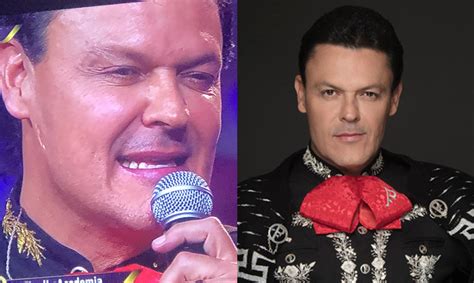 Fans Aseguran Que Pedro Fernández Está Deformando Del Rostro Por Botóx