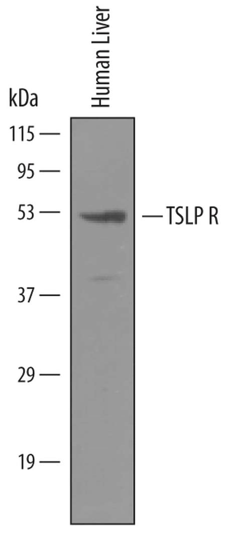Tslp Receptor Antibody Pa5 47979