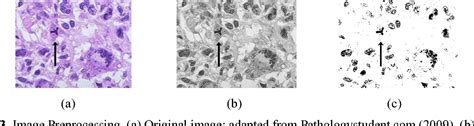 Figure 2 From An Algorithm For The Automatic Detection Of Abnormal Mitotic Figure Towards The