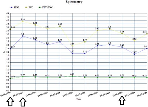Spirometry From Referral To End Of Follow Data For Fev1 And Fvc Are