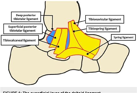 Figure 1 From Combined Deltoid And Spring Ligament Reconstruction Using