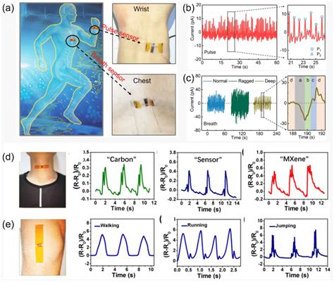 A Realtime Monitoring Of Physiological Signals Using A Self Powered Download Scientific