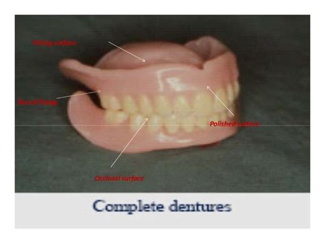 Anatomy For Complete Denture