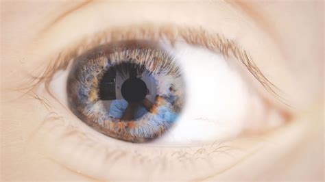 Rare Genetic Eye Diseases