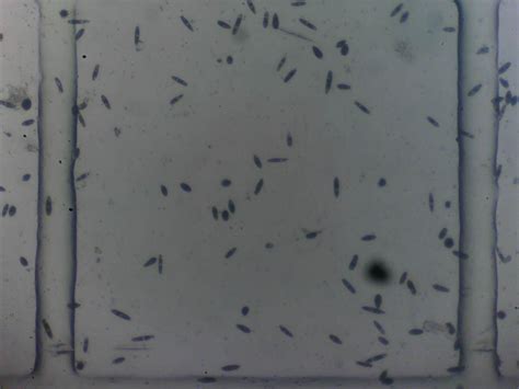 Shrimp Dectection Roboflow Universe