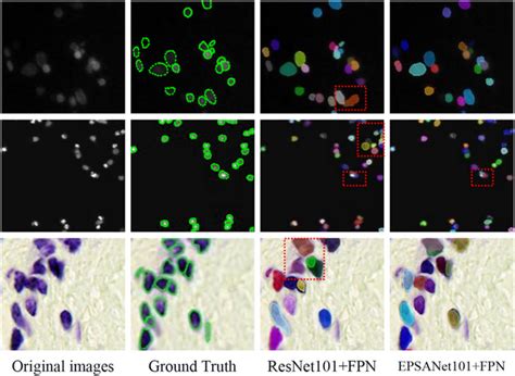 Visualizing The Segmentation Results Of The Two Backbone Networks The Download Scientific