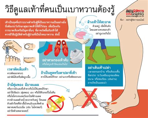 วิธีดูแลเท้าที่คนเป็นเบาหวานต้องรู้