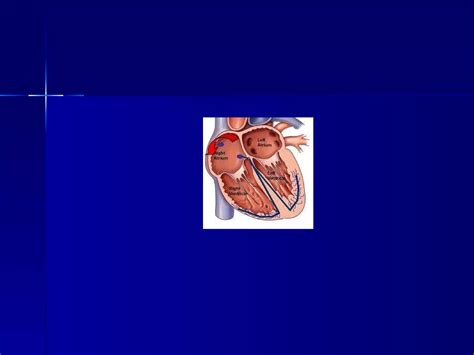 Tachyarrhythmia Ppt