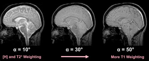 Spoiled Gre Questions And Answers In Mri