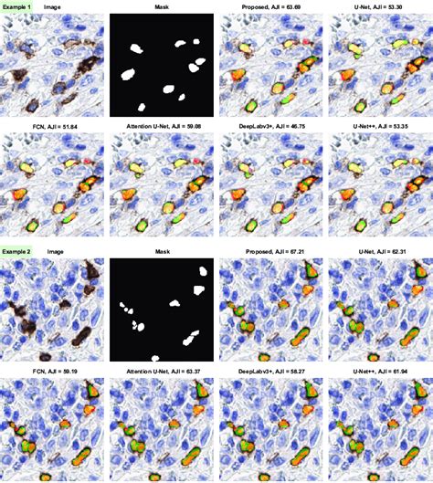 Illustration Of Proposed Model Segmentation Results Compare With Five Download Scientific