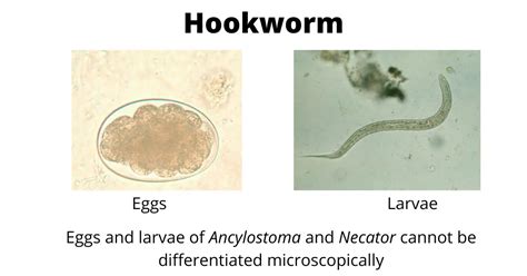 Hookworm Characteristics Life Cycle Pathogenesis And Diagnosis • Microbe Online