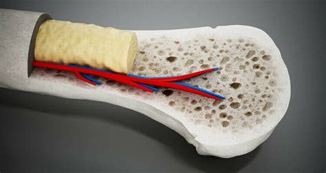 Médula ósea Anatomía Para Qué Sirve Y Enfermedades