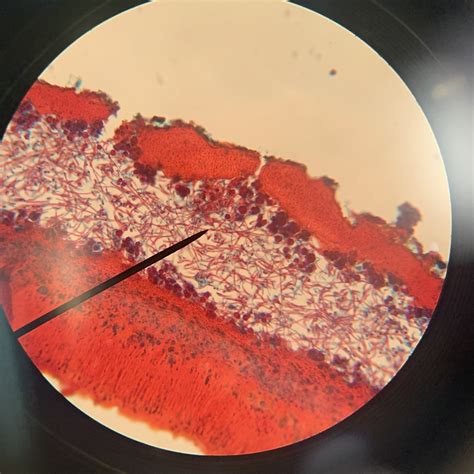 Lab2 Algae Fungi Lichen Part Iii Lichen Diagram Quizlet