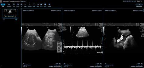 Its Works · Issue 66 · Knopkemdicomweb Pacs · Github
