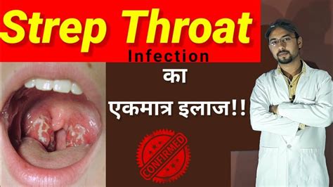 Sore Throat Pictures Infection