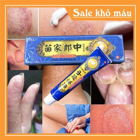 Green Cream Ringworm Itchy Fungus Horny Sweetener Green Shop