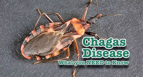 What You Need To Know About Chagas Disease Mega Doctor News