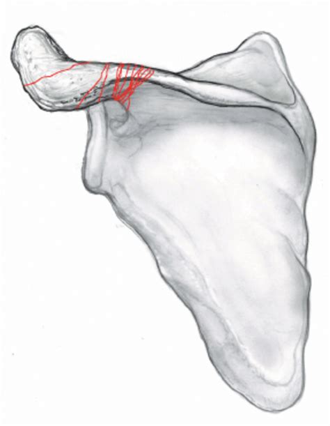Acromion Process Scapula Filecoracoid Process Of Scapula04png