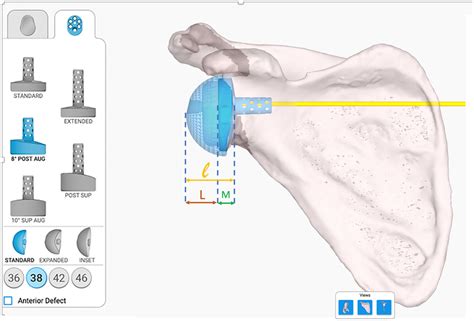 Graphic Image Of How The Lateralization Of The Cor Was Calculated As Download Scientific