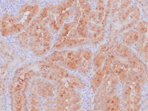 Galectin 3 Recombinant Ivd Antibody For Ihc Zeta Corporation