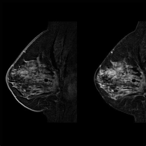 Soft Tissue Motion Correction Siemens Healthineers Usa