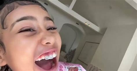 Kim Kardashians Daughter North West Unveils Dramatic Teeth