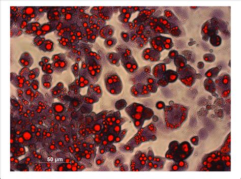 Histological Staining Of Lipids In Mature Brown Adipocytes Was